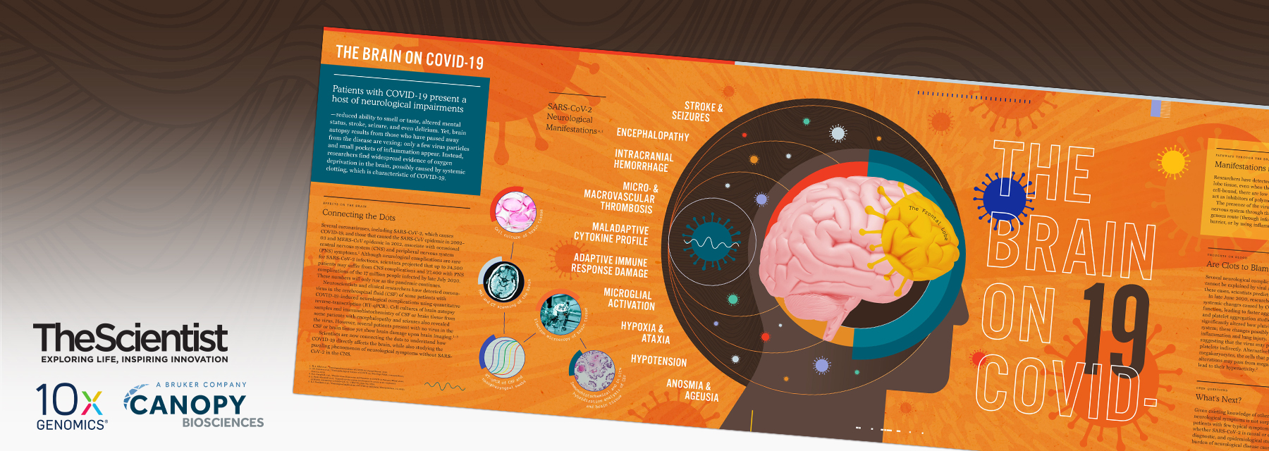 The Brain on COVID-19